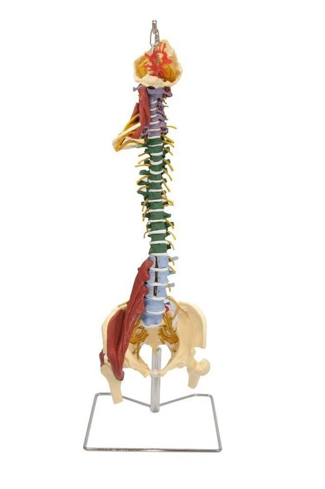 Anatomical Chart Company Muscle Spine with Disorders with Stand CH5900 ...